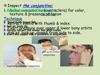 Conjunctiva Inspection