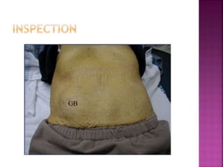 Obstructive jaundice | PPTX