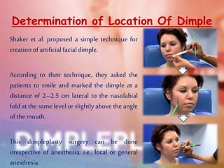 DIMPLEPLASTY | PPTX