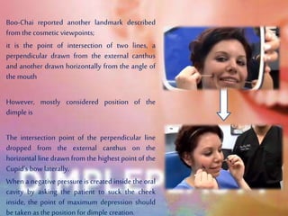 DIMPLEPLASTY | PPTX