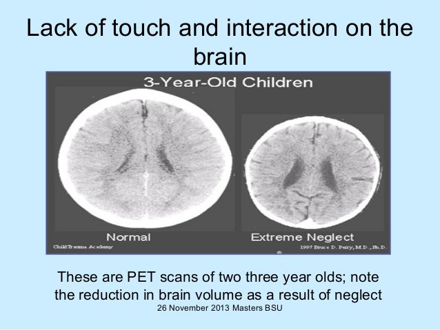 Attachment, Emotional Well-being and the Developing Brain Presentation
