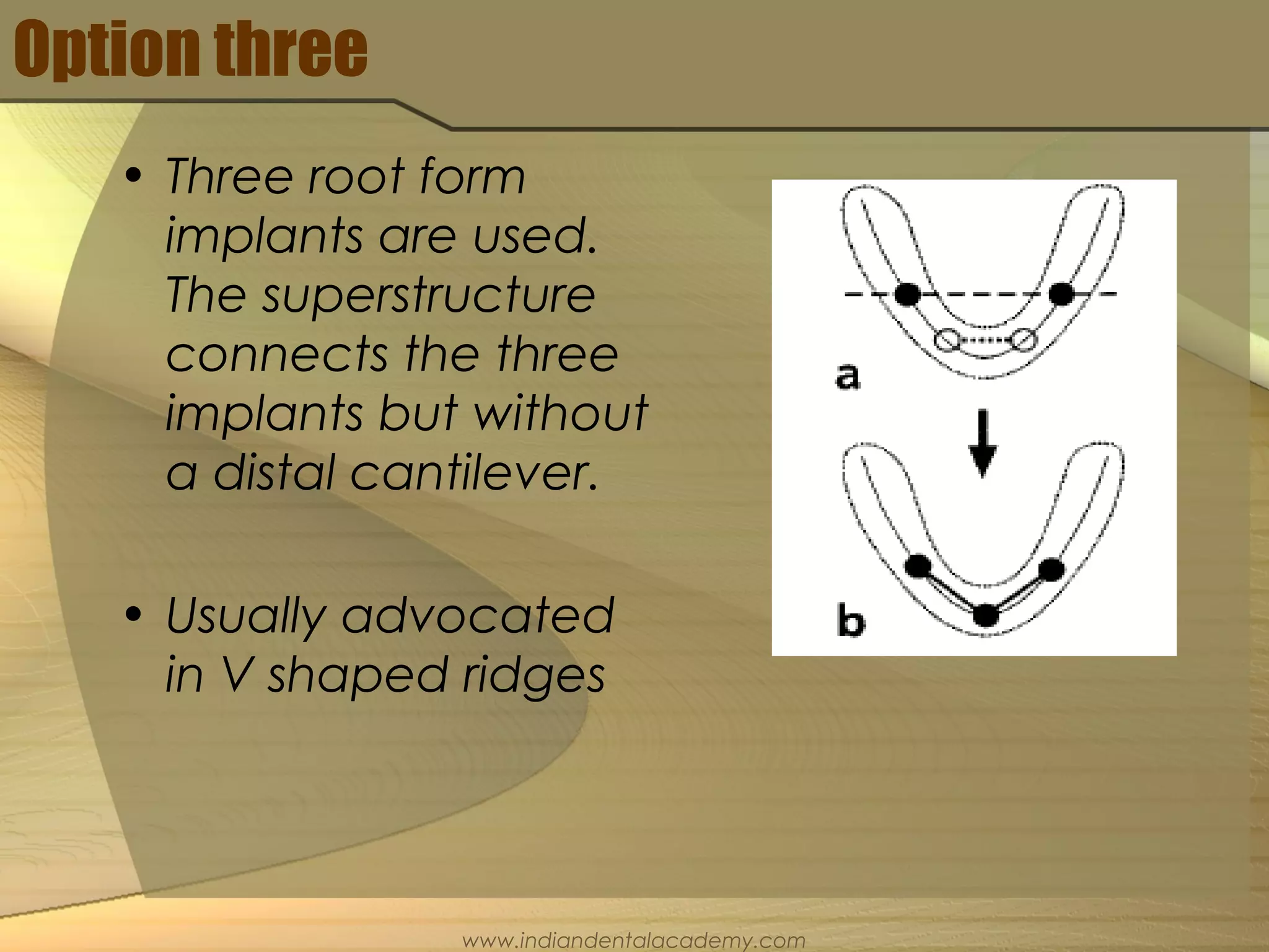 Attachments in implant retained overdentures/ cosmetic dentistry ...