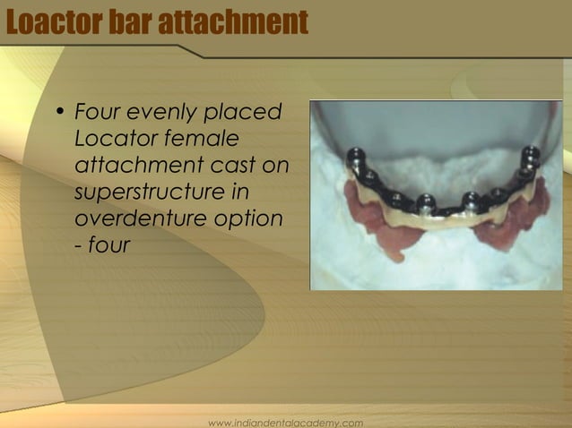 Attachments in implant retained overdentures/ cosmetic dentistry ...