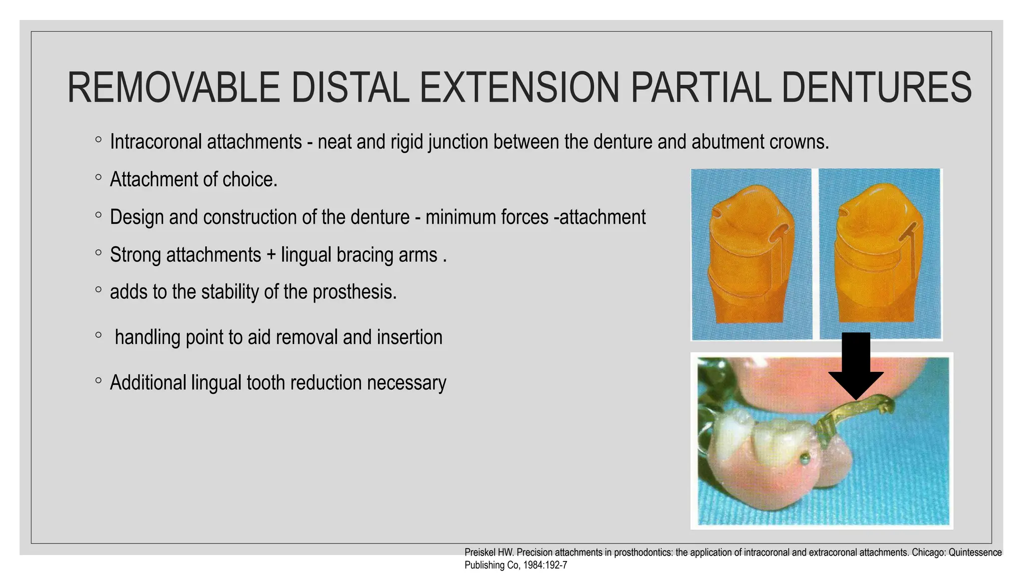ATTACHMENTS IN RPD.pptx MFS dentistry …// | PPTX