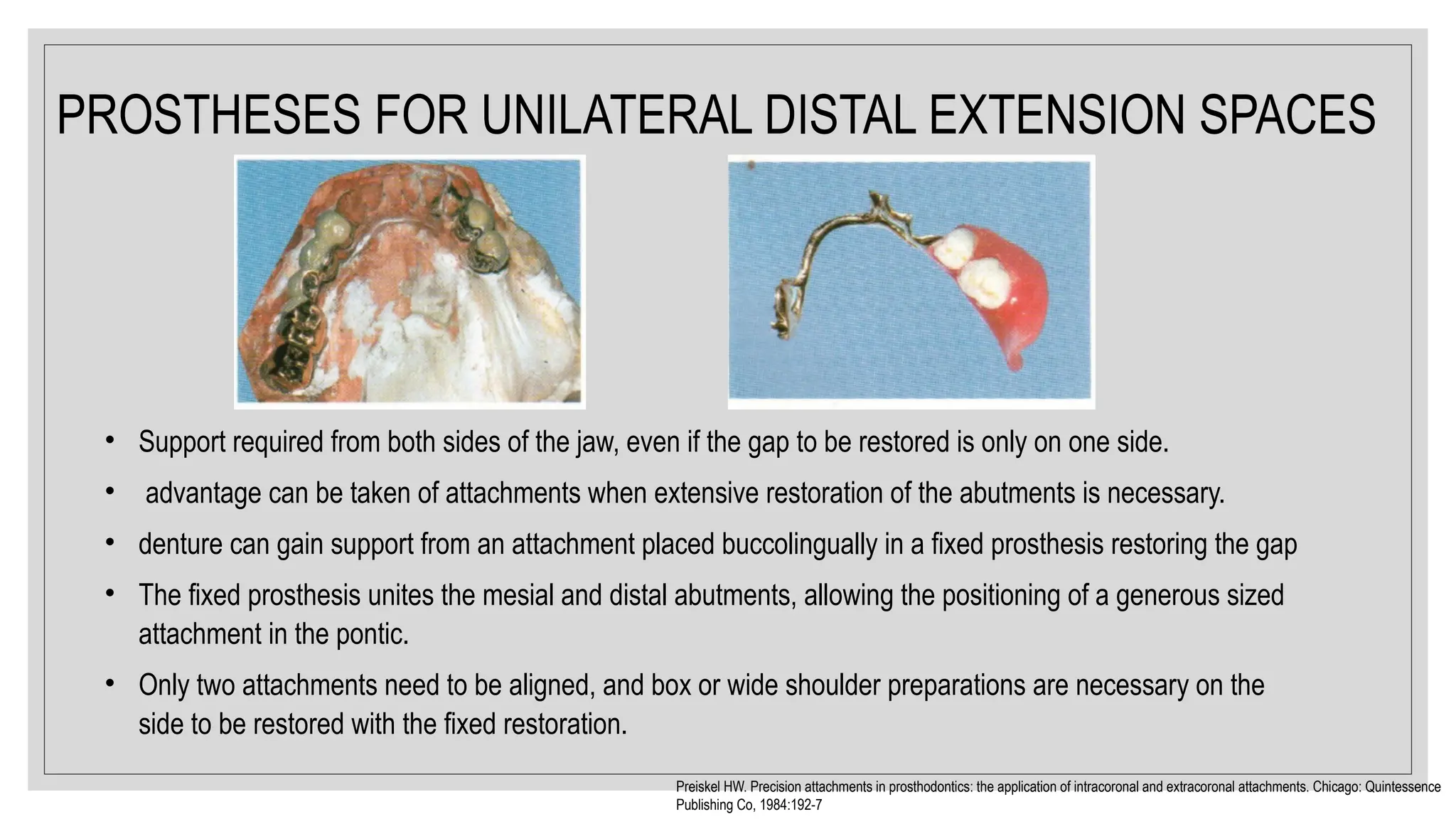 ATTACHMENTS IN RPD.pptx MFS dentistry …// | PPTX