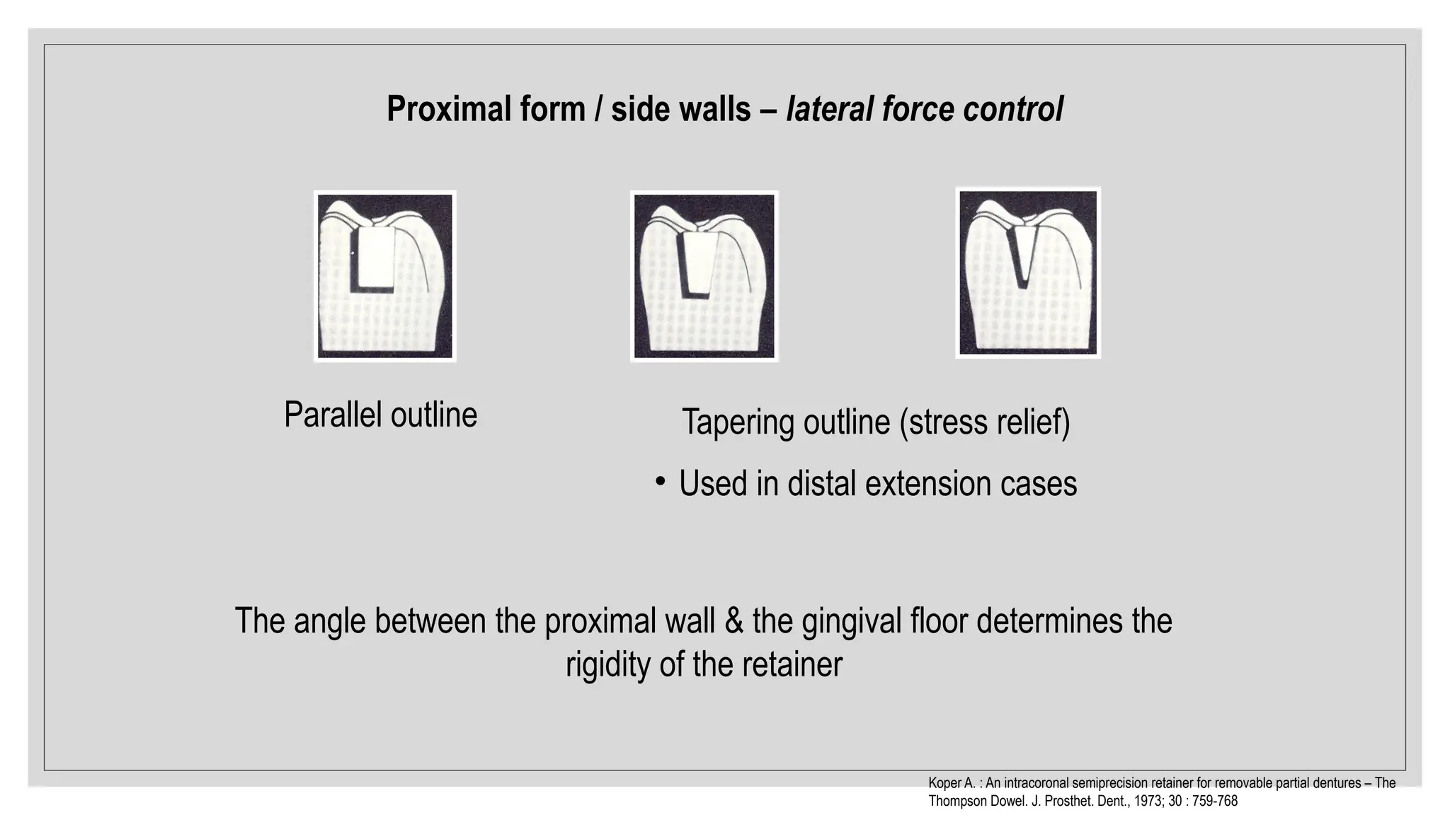 ATTACHMENTS IN RPD.pptx MFS dentistry …// | PPTX