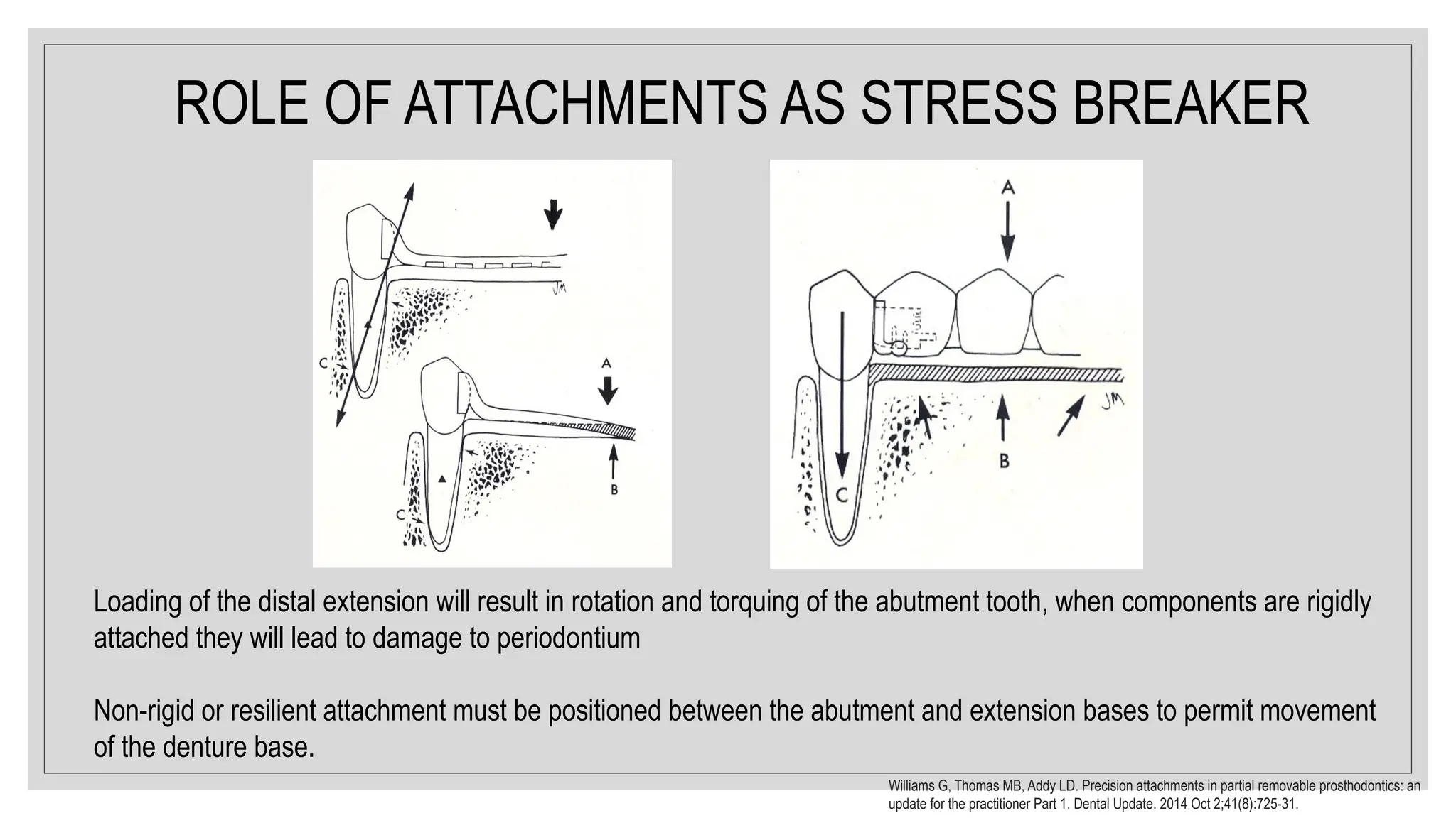 ATTACHMENTS IN RPD.pptx MFS dentistry …// | PPTX