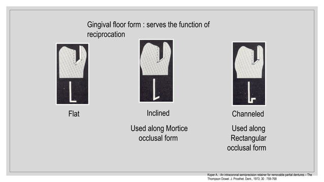 ATTACHMENTS IN RPD.pptx MFS dentistry …// | PPTX