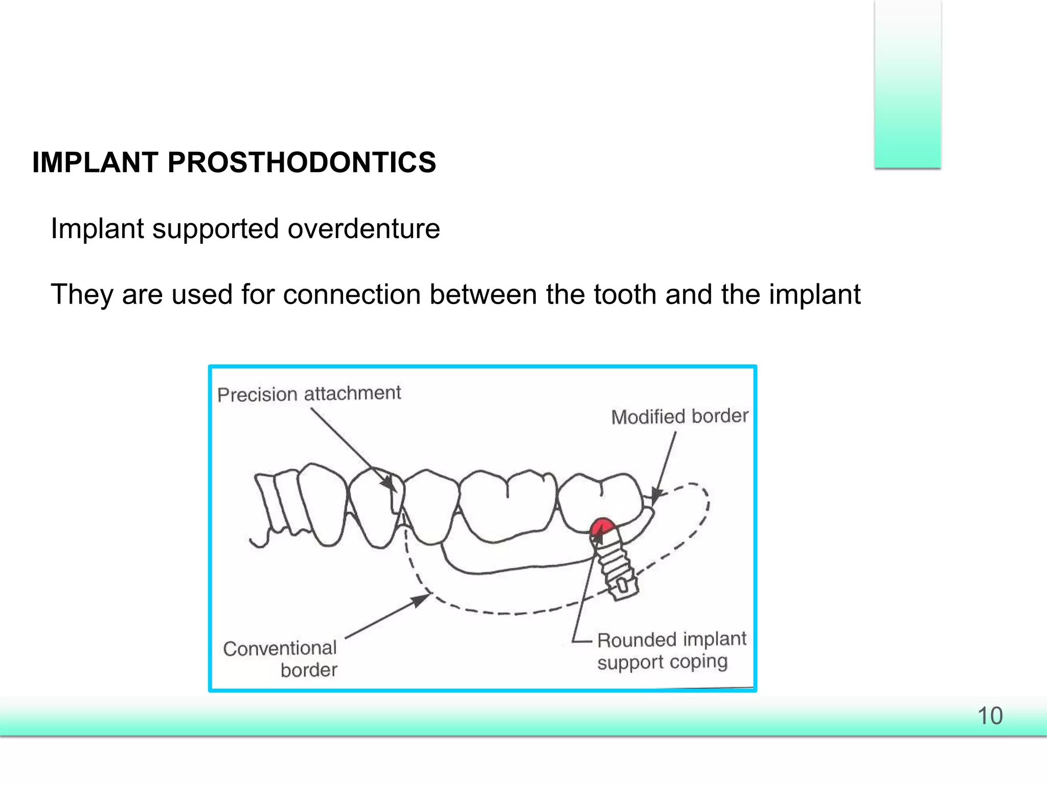 Attachments in removable partial prosthesis | PPTX