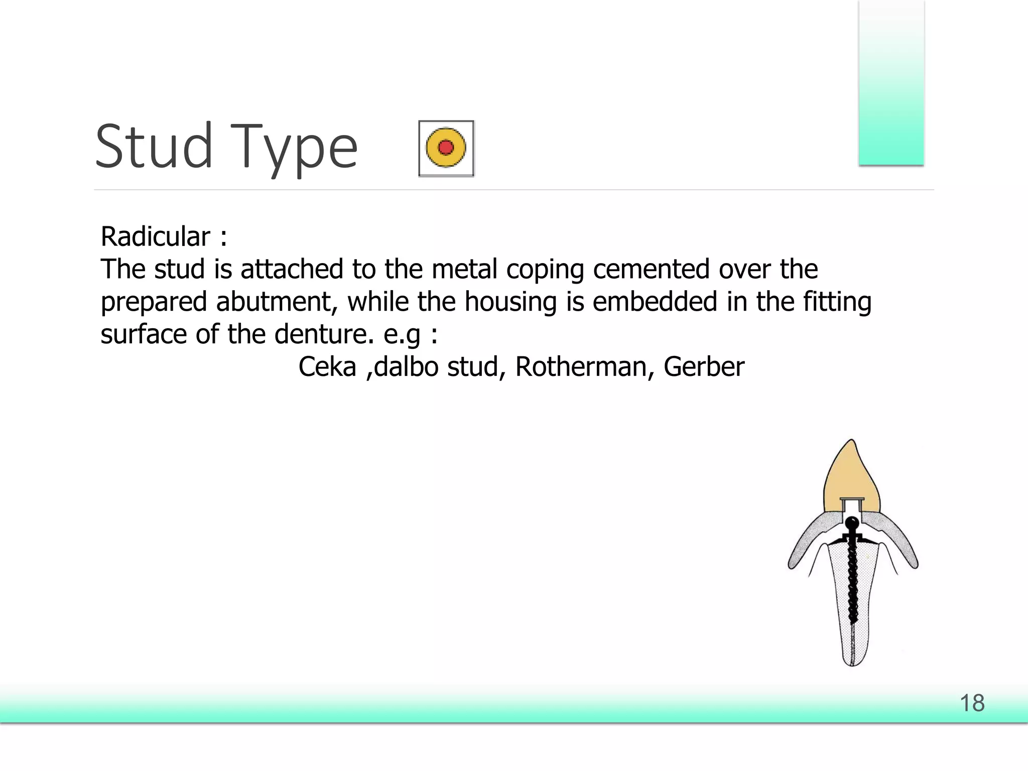 Attachments in removable partial prosthesis | PPTX