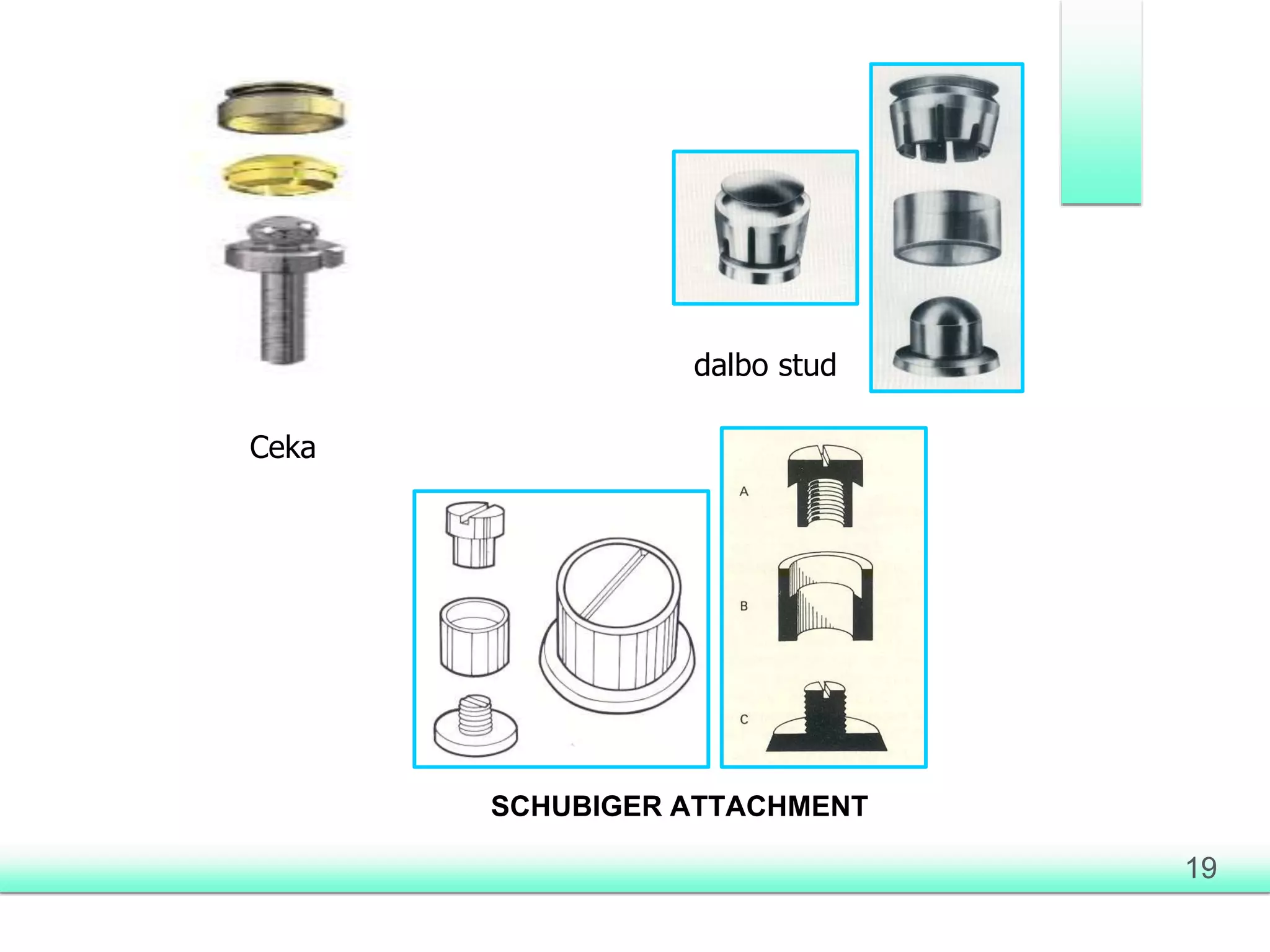 Attachments in removable partial prosthesis | PPTX