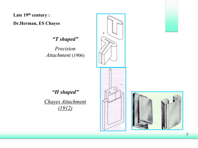 Attachments in removable partial prosthesis | PPTX