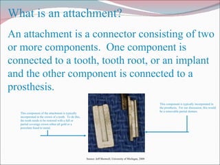 Attachments & their use in rpd fabrication | PPT