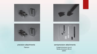 Attachment in Removable Prosthodontics: definition, Types ...