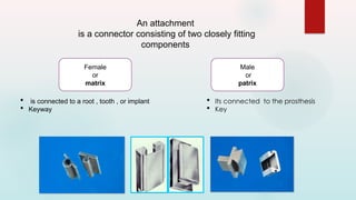 Attachment in Removable Prosthodontics: definition, Types ...