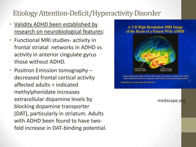 Attention deficit hyperactivity disorder | PPTX