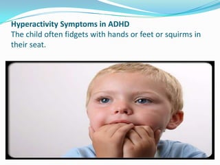 Attention deficit hyperactivity disorder | PPTX