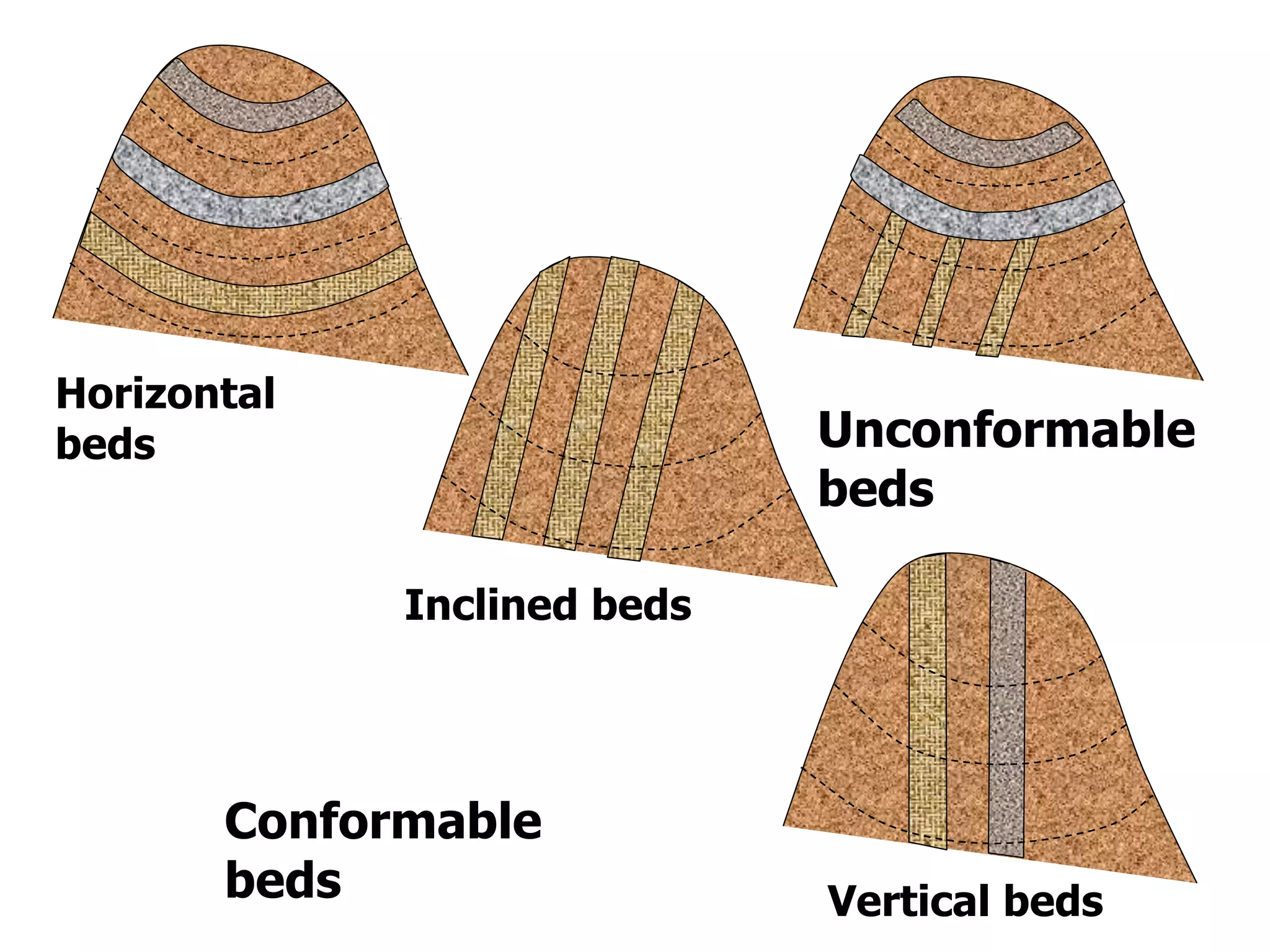 Attitude of beds | PPT