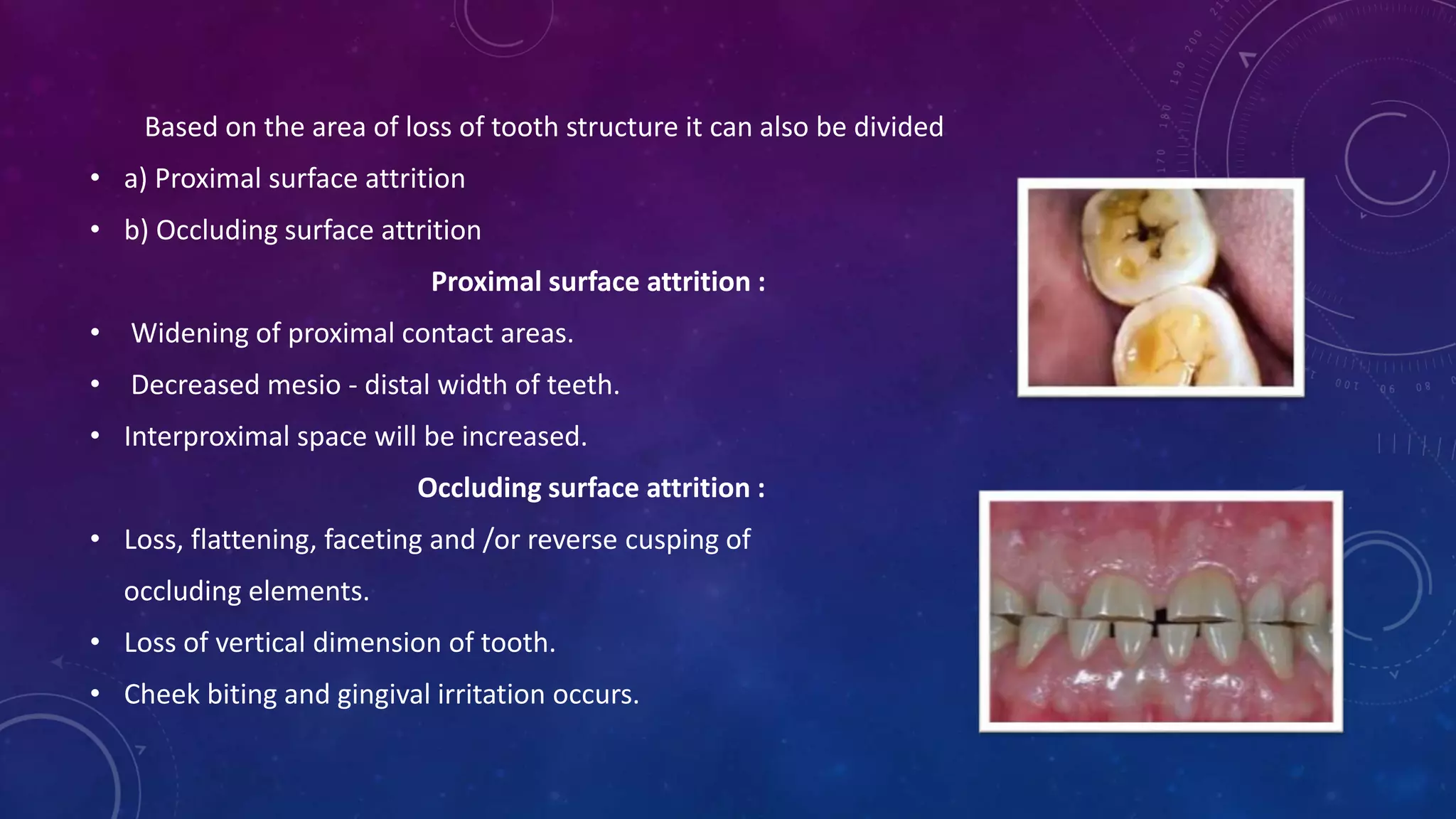 Attrition by Dr PC.pptx