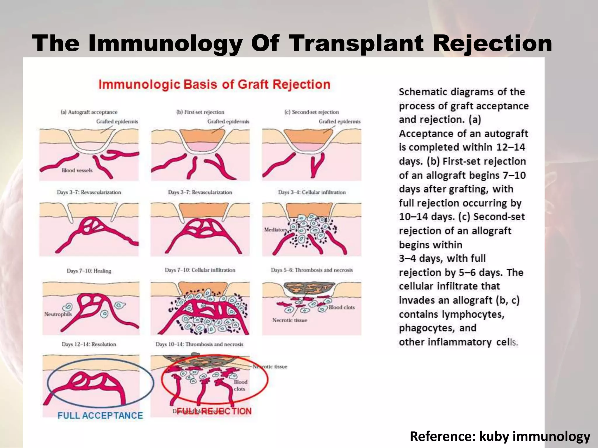 TRANSPLANTATION IMMUNOLOGY | PPTX
