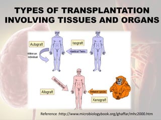 TRANSPLANTATION IMMUNOLOGY | PPTX