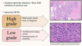 Dealing with ATYPIA and papillary lesions in IN BREAST | PPTX