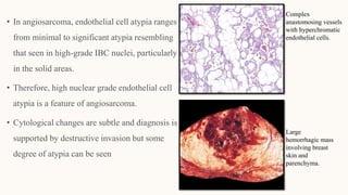 Dealing with ATYPIA and papillary lesions in IN BREAST | PPTX