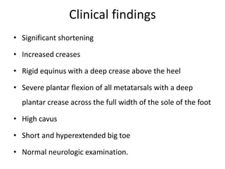 Atypical clubfoot, complex ctev, dx.pptx