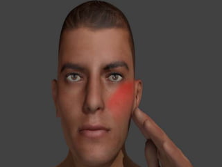 Atypical facial pain | PPTX