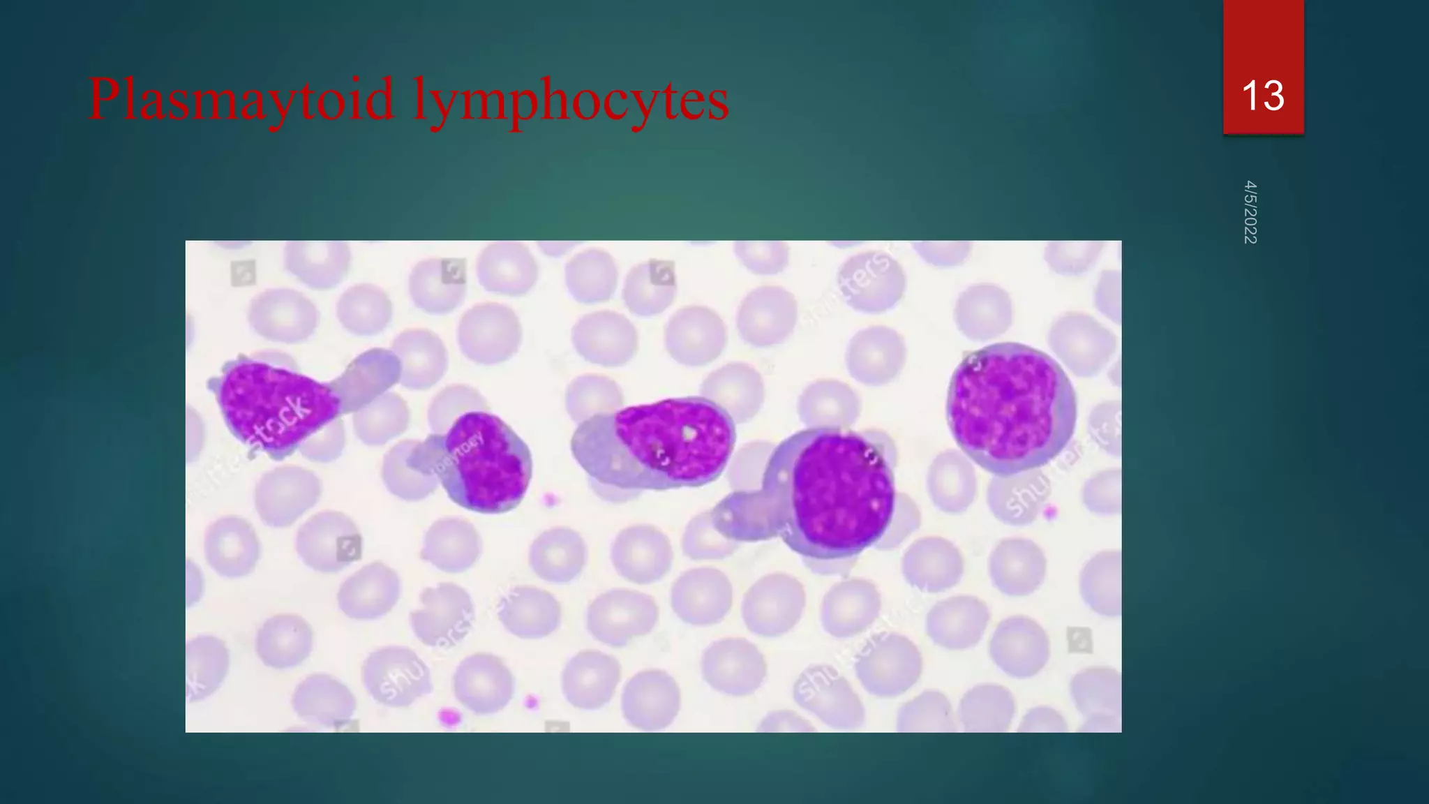 Atypical lymphocytes | PPT