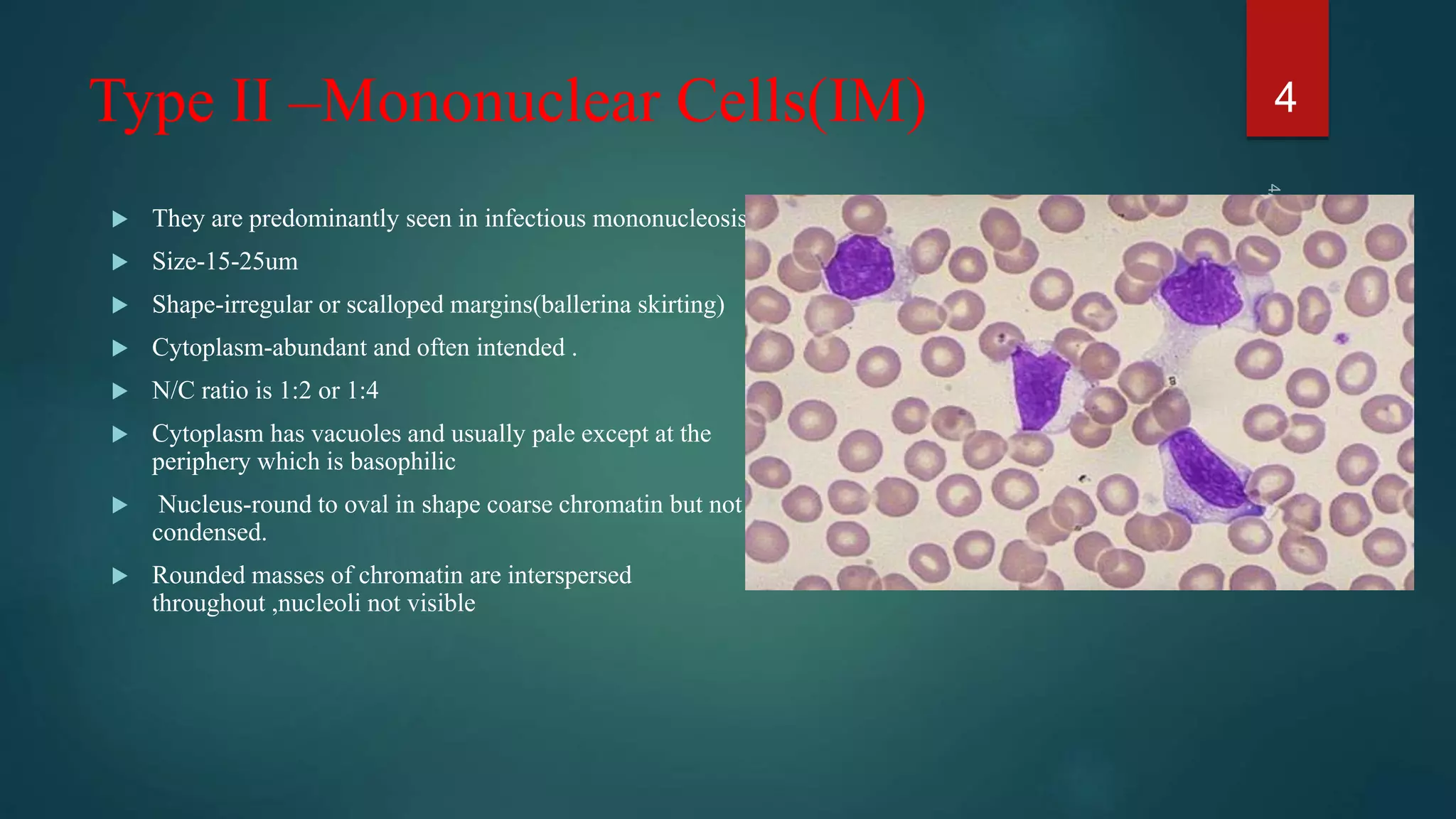 Atypical lymphocytes | PPT