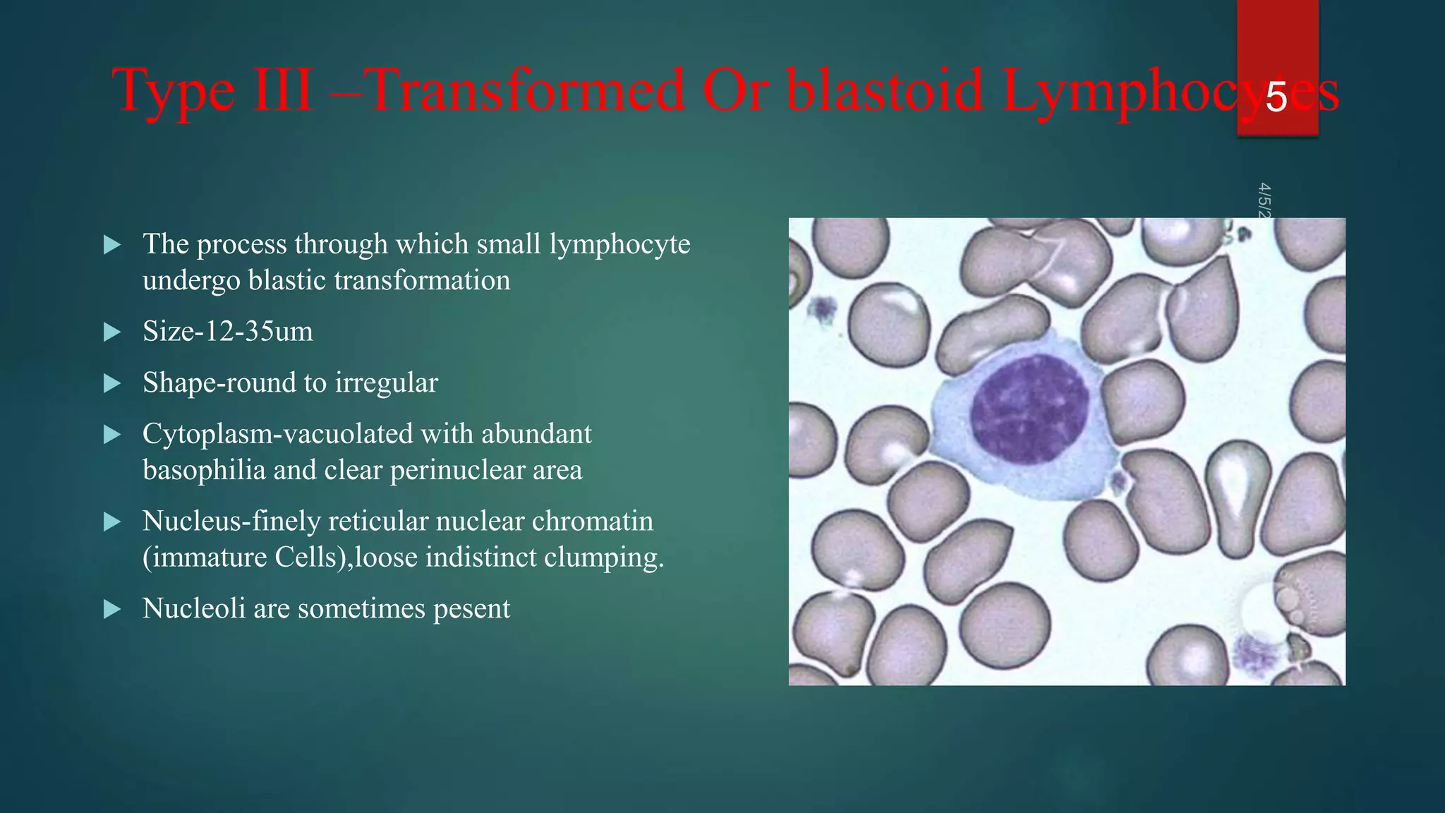 Atypical lymphocytes | PPT