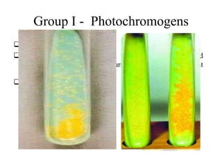 Atypical mycobacteria | PPTX