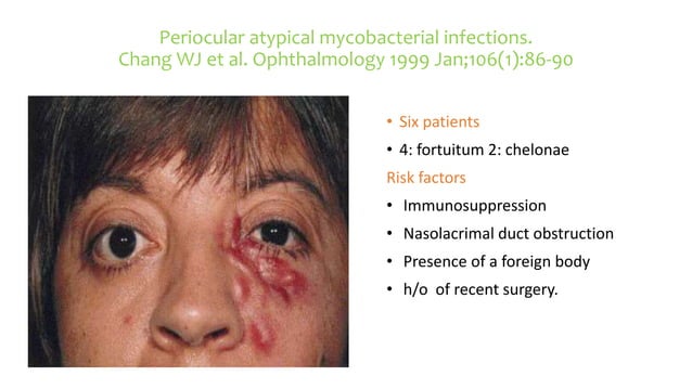 Atypical mycobacterial infections in dermatology | PPTX | Infectious ...