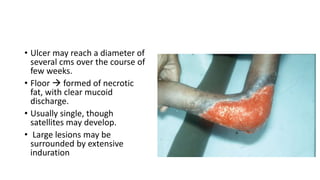 ATYPICAL MYCOBACTERIAL INFECTIONS AND THEIR MANIFESTATIONS | PPTX