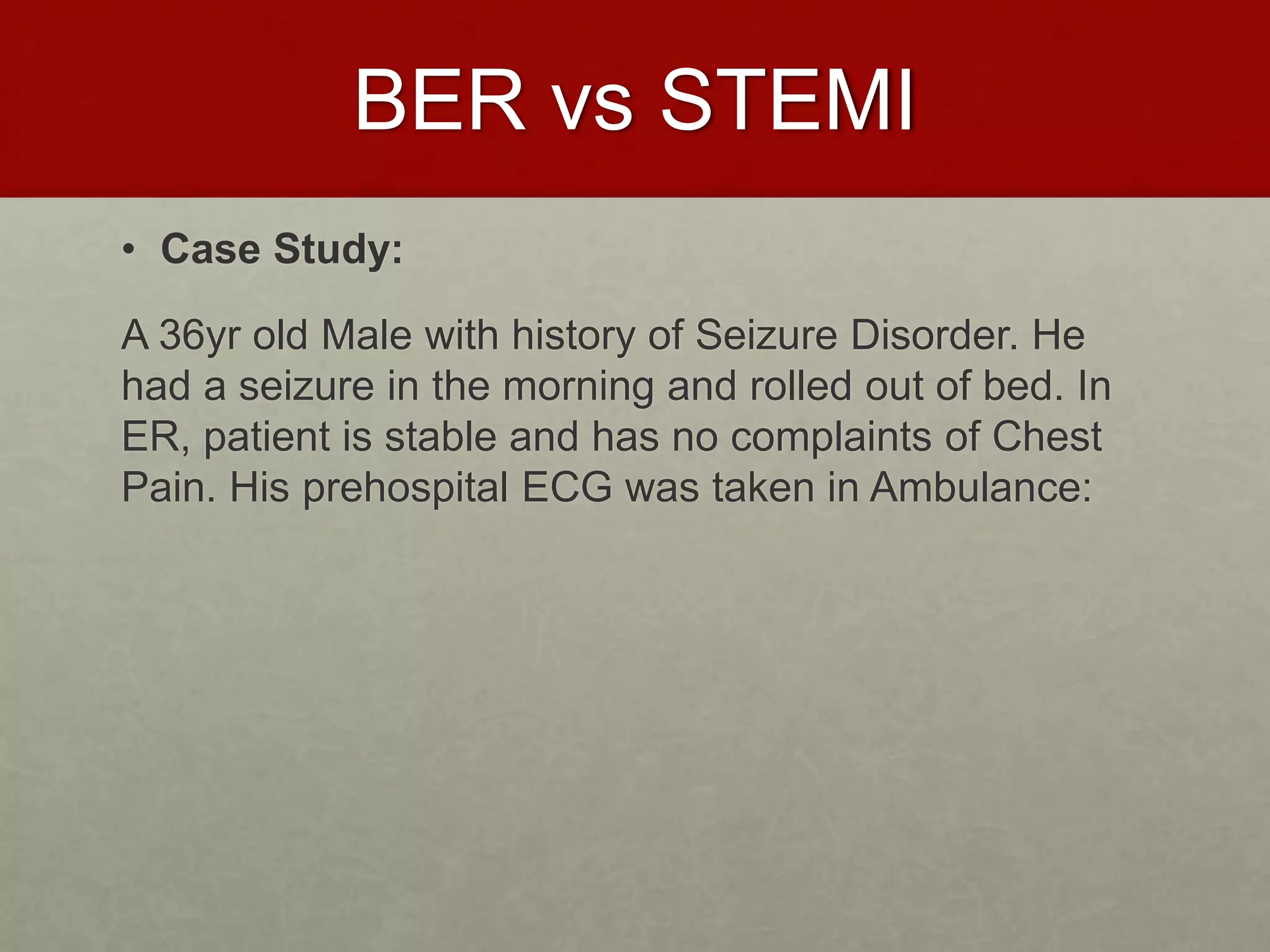Atypical stemi patterns and stemi equivalents | PPTX