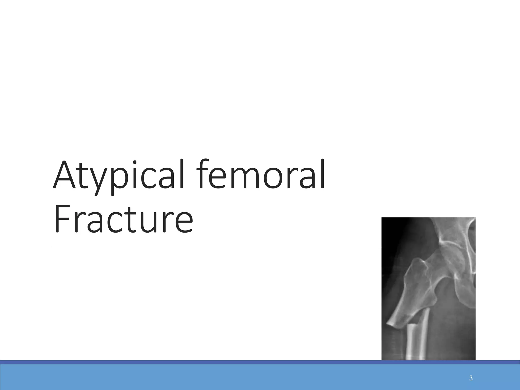 Management of atypical THA periprosthetic fracture | PDF