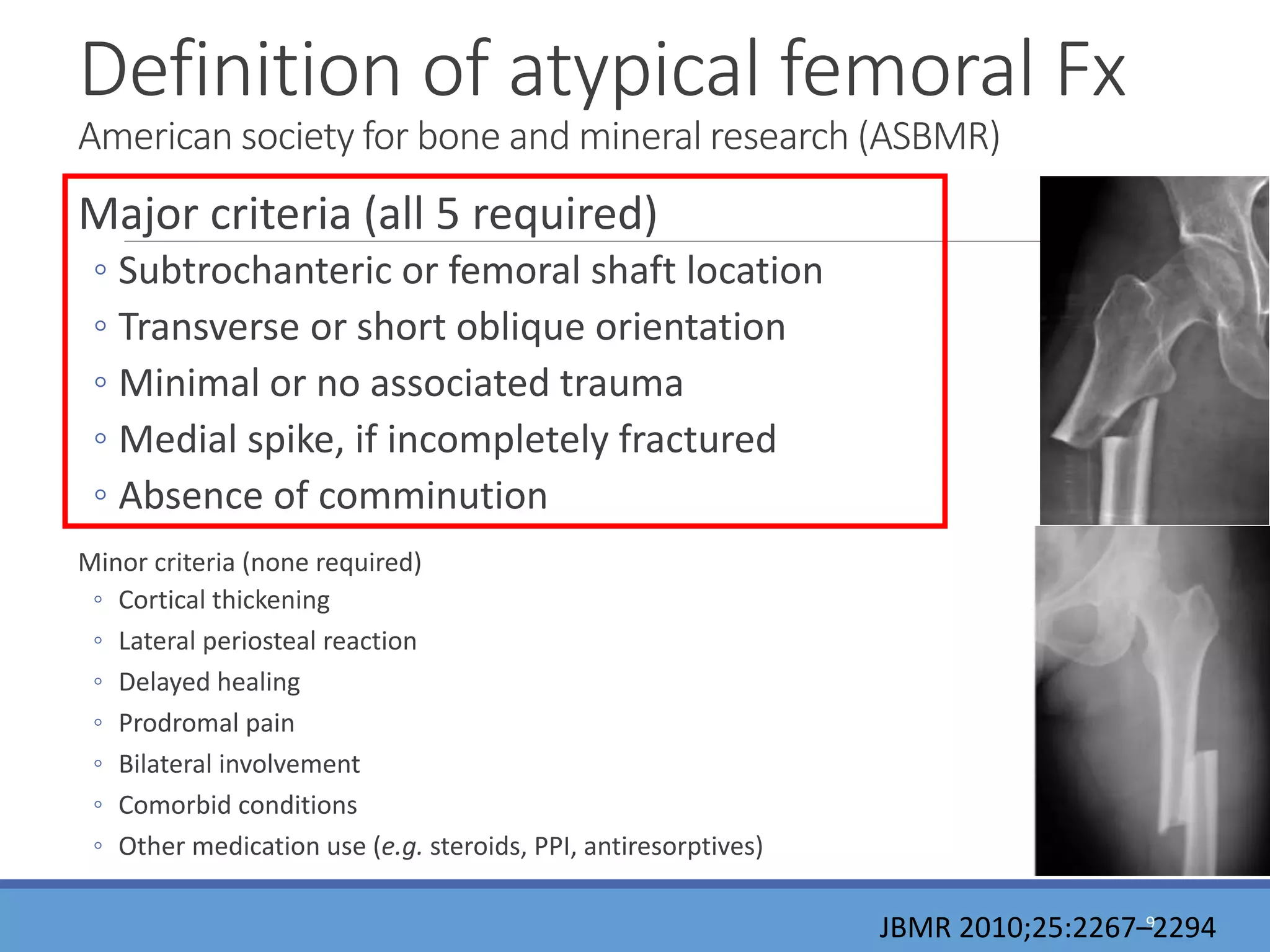 Management of atypical THA periprosthetic fracture | PDF