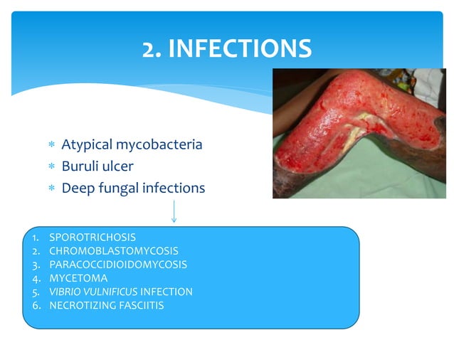 Atypical wounds | PPTX