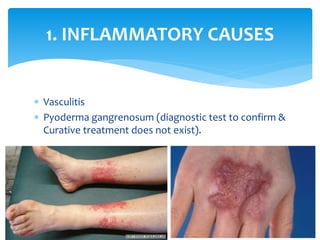 Atypical wounds | PPTX