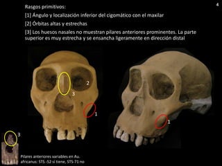 Australopithecus sediba | PDF