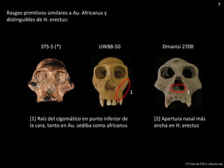 Australopithecus sediba | PDF