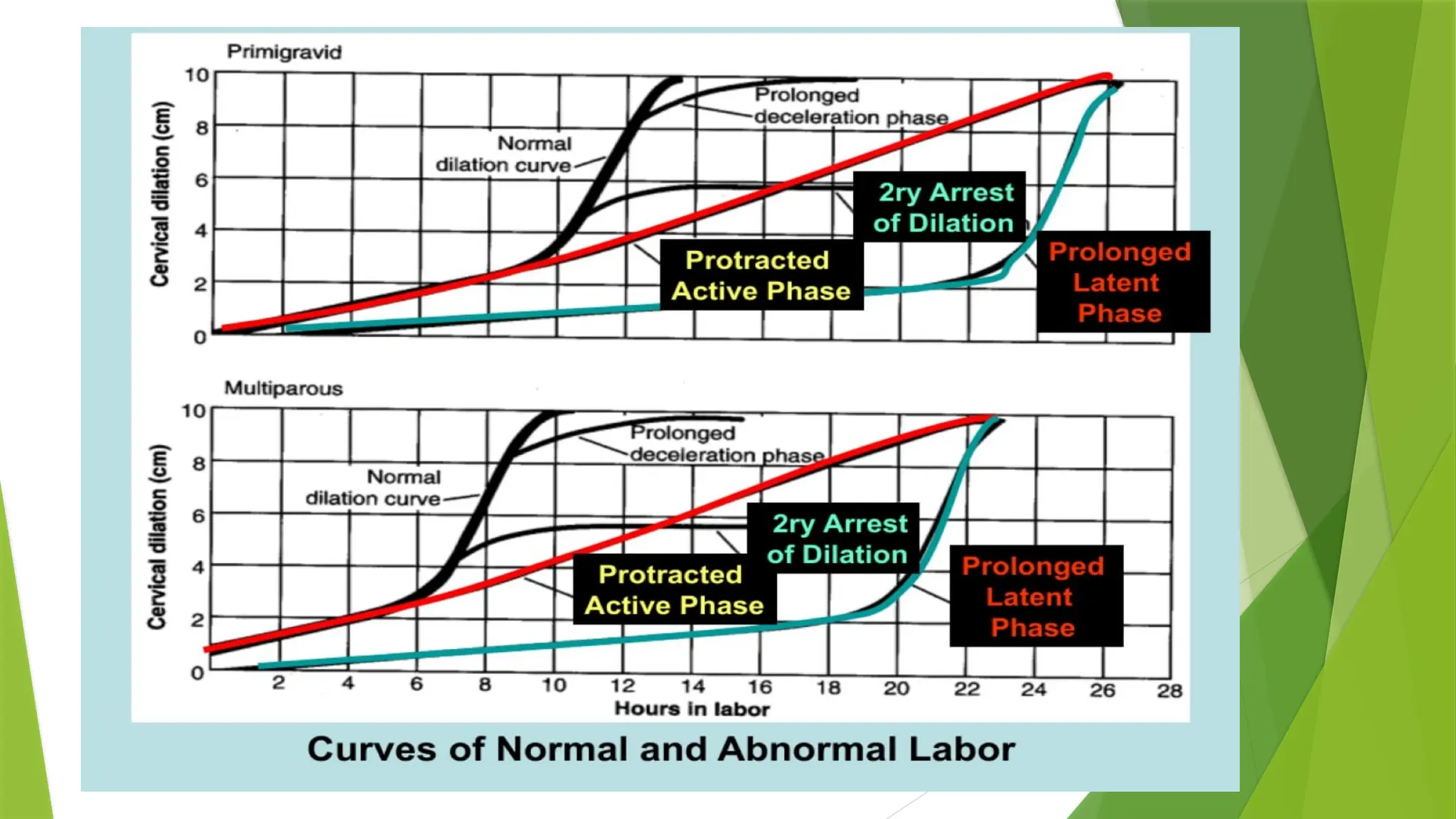 Abnormal uterine bleeding, types, classification | PPTX