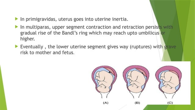 Abnormal uterine bleeding, types, classification | PPTX | Pregnancy ...