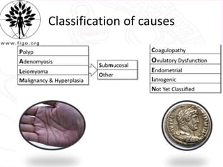 AUB : Definition, Epidemology and Causes | PPTX | Pregnancy ...
