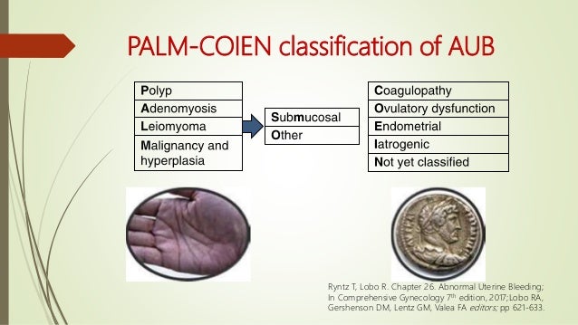 Abnormal Uterine Bleeding