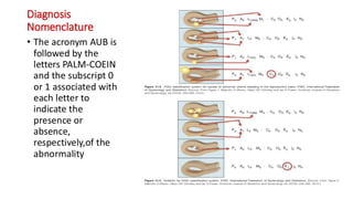 Abnormal uterine bleeding definition ppt | PPT
