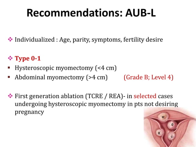 Insight AUB Management Guidelines on AUB in Reproductive Period | PPTX ...