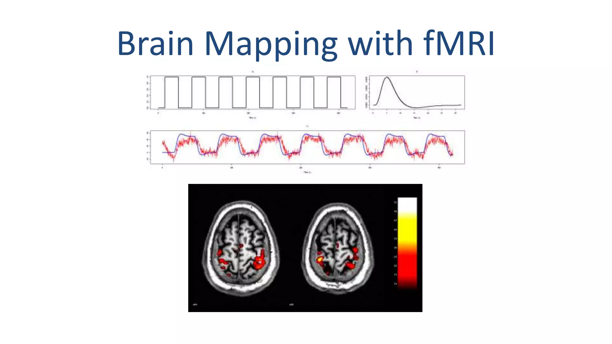 Introduction To Resting State Fmri Preprocessing And Analysis Ppt