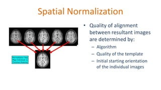 Introduction to resting state fMRI preprocessing and analysis | PPTX